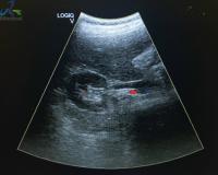 China GE 4C-RS Curved Array Abdominal Ultrasound Probe Hospital Instrument for sale