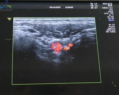 China GE Logiq E9 ML6-15-D Breast Ultrasound Probe Repair Linear Vascular Transducer for sale