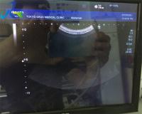 China Toshiba PVU-375BT  Convex Array Ultrasound Transducer Probe 6.0MHz In Hospital for sale