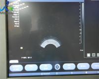 China Siemens EC9-4 Compatible Ultrasound Transducer Endocavity Probe X300 System In Hospital for sale