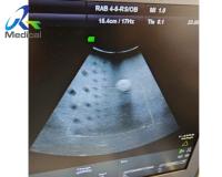 China GE RAB4-8-RS Ultrasound Probe Repair Dome Original Condition Oil Filling for sale