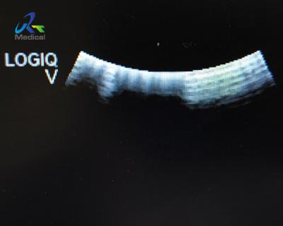 China Efficient Ultrasound Probe Overhaul Maintenance And Repair Service for sale