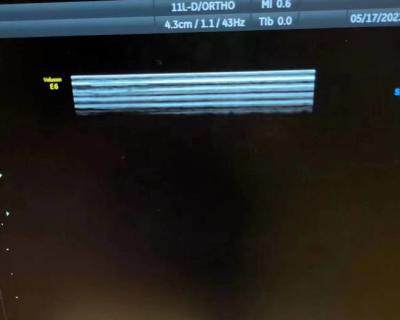 China GE 11L-D Linear Ultrasound Probe Transducer Hospital Equipment Imaging System for sale
