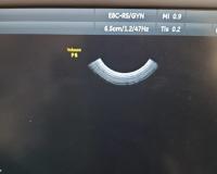 China GE E8C-RS Compatible Ultrasound Probe Intracavity Transducer Electronic Diagnostics For Medical Imaging for sale
