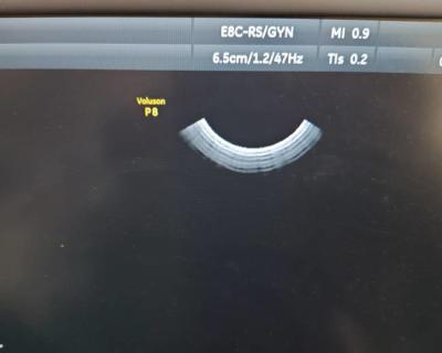 China GE E8C-RS Compatible Ultrasound Probe Intracavity Transducer Electronic Diagnostics For Medical Imaging for sale
