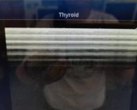 China Linear Array Ultrasound Transducer Probe Toshiba PLT-704SBT 11L4 For Hospital for sale
