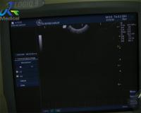 China GE E8C 11.5MHz Medical Ultrasound Probe Intracavity Transducer For Diagnosis Device for sale