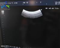China Aloka UST-9123 60Mm Used Ultrasound Probe Convex Supersonic Sensor for sale
