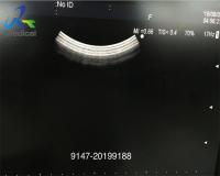China Aloka UST-9147 Curved Ultrasound Probe For Abdominal Diagnostic Medical Device for sale