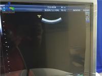 China Gynecological Used Curved Probe Ultrasound Logiq E9 System for sale