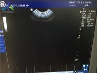 China GE E8CS-RS Used Ultrasound Probe Logiq F8 Hospital Equipment Endovaginal for sale