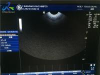 China Microconvex Used Ultrasound Probe For Endocavity for sale