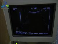 China Used Ultrasound Transducer Probe Hitachi EUP-C516 60mm Convex Abdominal/Echo Scanner for sale