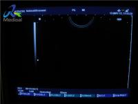China Hitachi EUP-V53W Endocavity 10mm Ultrasound Transducer Probe for sale