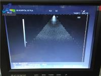 China Medical Ultrasound Scanner Hitachi EUP-S50 Phased Array/Scan Shot for sale