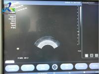 China Urology Endocavitary Ultrasound Transducer Probe Siemens EC9 4 for sale