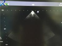 China Toshiba PST-30BT Sector Cardiac Ultrasound Transducer Probe Medical Parts for sale