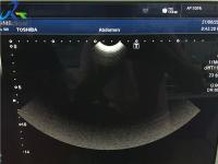 China Toshiba PVT-712BT 11MC4 Micro-Convex Ultrasound Probe/Neonatal imaging for sale