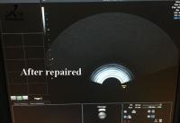 China Replace Lens Ultrasound Probe Repair GE RIC5 9 D for sale
