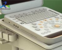 China Ultrasonic Board  CX50 Control Board Imaging Device sonic cleaning machine 453561685791 for philips for sale