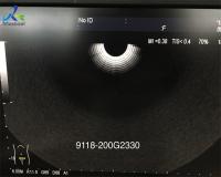 China UST-9118 9mm Ultrasound Transducer Probe Echo Scanner for sale