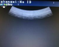 China Aloka UST-9123 60Mm Used Ultrasound Probe Convex Supersonic Sensor for sale