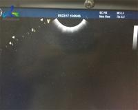 China GE 8C-RS Ultrasound Transducer Probe Micro Convex Pediatric Transcranial Imaging Center Facility for sale