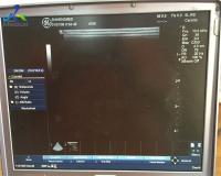 China 10.0MHz Ultrasound Scanner Probe GE 8L-RS Linear Versatile Pediatric Abdomen Medical Service for sale
