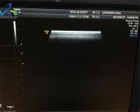 China 16MHz GE SP10-16-D Ultrasound Transducer Probe 2D Linear Radiography Machine for sale