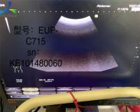 China EUP-C715 Abdominal Ultrasound Probe Imaging Diagnosis Equipment Care Supplies for sale
