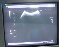 China 5.5MHz Canon PVT-382BT Abdominal Convex Probe Physical Therapy Equipment for sale