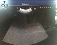 China PVT-674BT Micro Convex Ultrasound Transducer Probe High Frequency Aplio 50 Ultrasonido Device for sale