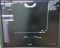 China EV-8C4 Ultrasound Scanner Probe Endocavitary Healthcare Equipment for sale