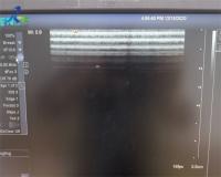 China 13MHz VF13-5 Ultrasound Transducer Probe For Superficial Medical Imaging Device for sale
