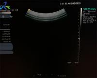 China Cypress 4C1 Convex Ultrasound Transducer Probe Abdominal Vascular Hospital for sale