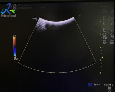 China GE 4C-RS Ultrasound Probe Repair Crystal Replacement Imagine Problem for sale