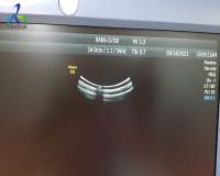China 3D Ultrasound Probe Repair GE RAB-6-D Transducer Abnormal Image With Air Bubble for sale