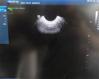 China Mindary DE10-3E Ultrasound Probe Repair Connecting Cable for sale