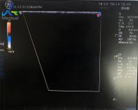 China GE 12L-RS Ultrasound Probe Repair For Crystal Array Replacement for sale