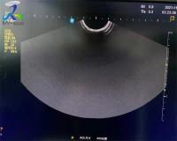 China Samsung ER4-9 Ultrasound Probe Repair Replace Lens for sale