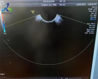 China GE IC5-9-D Ultrasound Probe Repair For Lens Replacement Original for sale