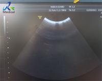 China GE RAB2-5-D Ultrasound Transducer Repair For 3D Crystal Array Dome Replacement for sale