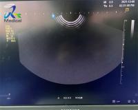 China Original Dark Shadows Ultrasound Probe Repair Lens Blistered for sale