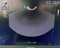 China Samsung EVN4-9 Ultrasound Probe Repair Imaging With Dark Shadows for sale
