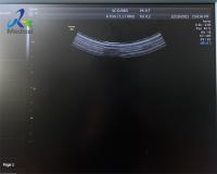 China Replace Lens Ultrasound Probe Repair GE 4C-D Strain Relief for sale