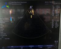China Housing Cracked GE 3S Ultrasound Probe Repair For Crystal Array Replacement for sale