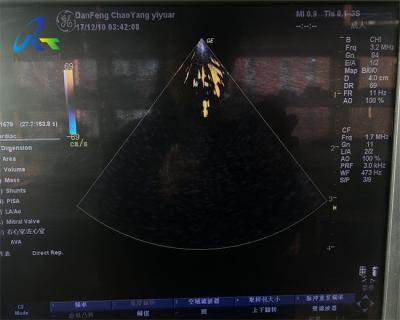 China Housing Cracked GE 3S Ultrasound Probe Repair For Crystal Array Replacement for sale