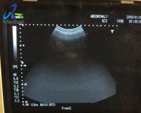 China Convex Array Transducer Toshiba PVQ-375A Ultrasound Probe For Famio 5 SSA-510A for sale