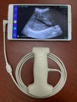 China 5V Dual Head Portable Handheld Ultrasound Scanner High Frequency for sale