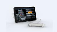 China 5V Dual Head Portable Handheld Ultrasound Scanner High Frequency for sale